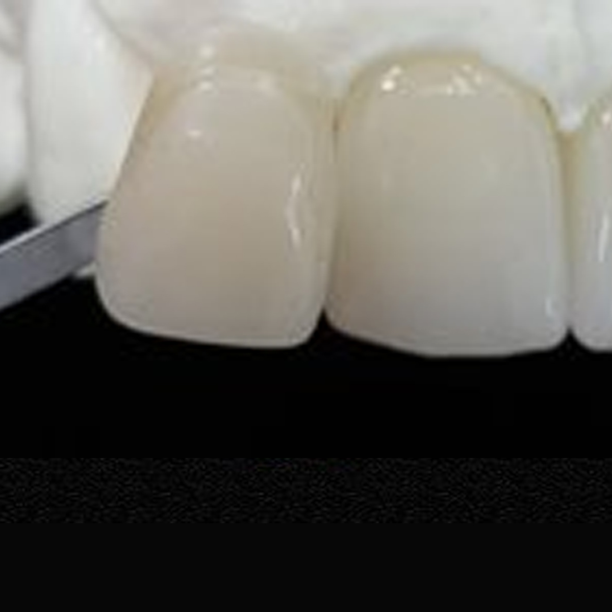 Talladiummillingcenter | Dental Lab Supplies at Talladium, Inc.