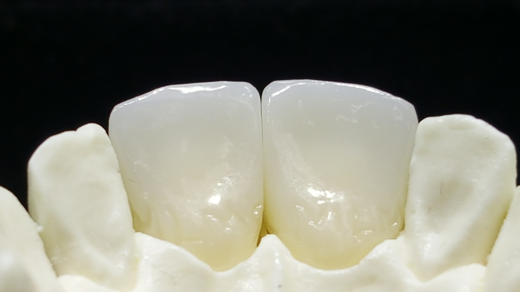 One For All Multi-Layer (98mm) | Dental Lab Supplies at Talladium, Inc.